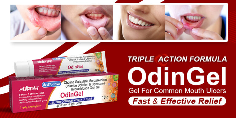 Mouth Ulcer Treatment