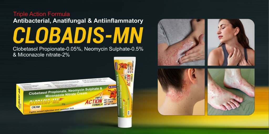 Best Creams for Skin Infections: Know About Skin Creams